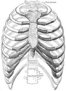 Sternal Fracture - Trauma ICU